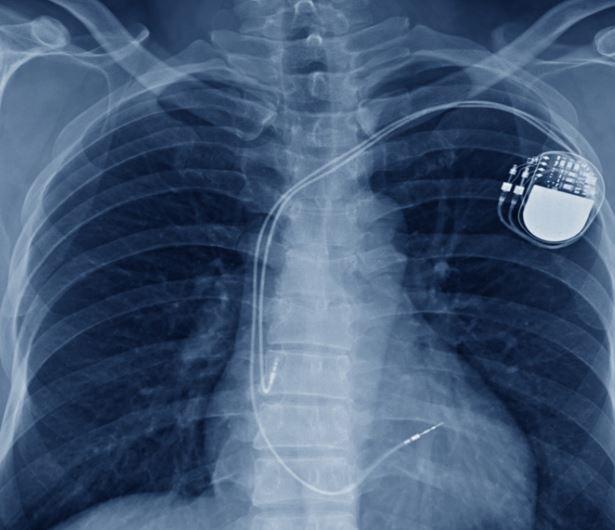 Honoring Black Inventors - Discovery Place Science Museum